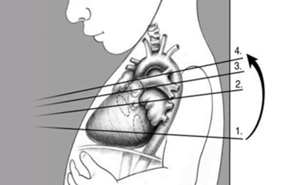 Updates in Fetal Echocardiography: Fetal Echo for Complex CHD - CHOP OPEN