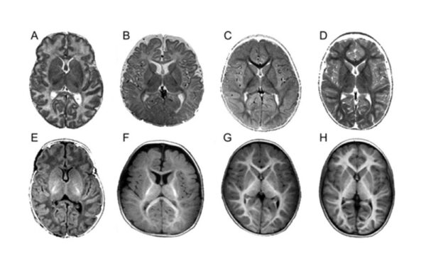 Introduction to Brain Imaging - CHOP OPEN