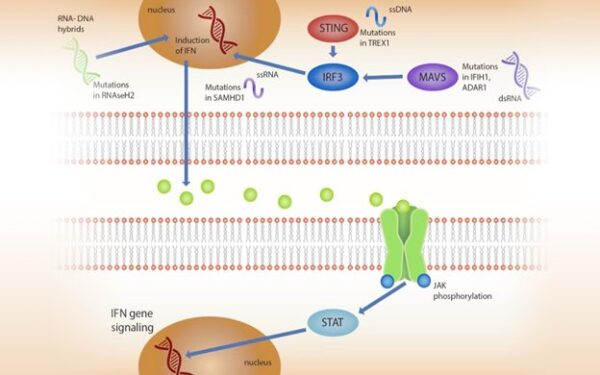 Aicardi Goutieres Syndrome: Diagnosis and Management - CHOP OPEN
