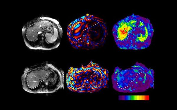 Introduction to Pediatric Radiology: Imaging the Future - CHOP OPEN