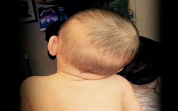 Weird Baby Movements - CHOP OPEN