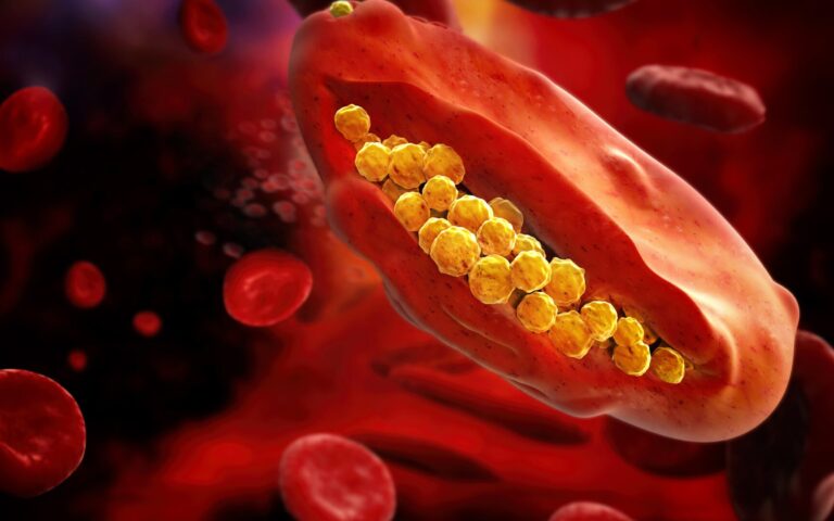 Parasites, Puzzles and Poetry: Deciphering Severe Malaria - CHOP OPEN